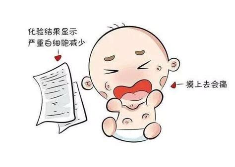 宝宝颈部淋巴结突然肿大家长需警惕这几种疾病 血常规