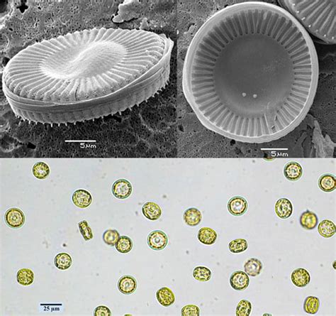 Phycokey Cyclotella Images