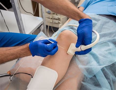 Radiofrequency Ablation In Baner Get Safe And Effective Treatment For Skin Conditions