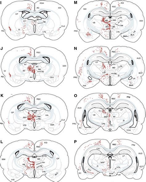Anatomical Analysis Of Afferent Projections To The Medial Prefrontal Cortex In The Rat