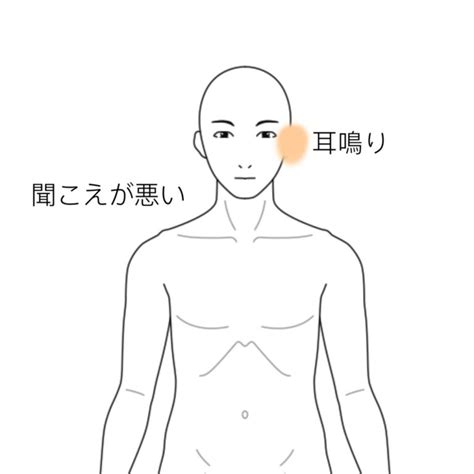 突発性難聴による聴力の低下耳閉感耳のつまり突発性難聴のツボツボネット 鍼灸の症例が検索できるツボ辞典