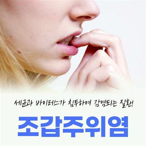 수유역신경외과 조갑주위염 조심 손톱 거스러미 뜯지 마세요 네이버 블로그