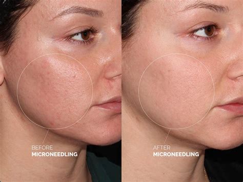 Skinly Aesthetics Best Medical Spa Nyc Cosmetic Dermatology