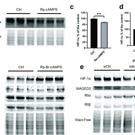 Proposed Model For Maged2′s Role Under Hypoxia Created With