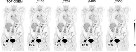 Figure 1 From Evaluation Of Penalized Likelihood Estimation