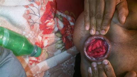 Bangladeshi Gay Boy In Bengali Anal Porn XHamster