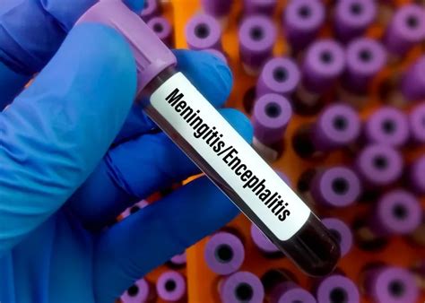 Hope For Cheaper Effective Meningitis Jab After African Trial Success