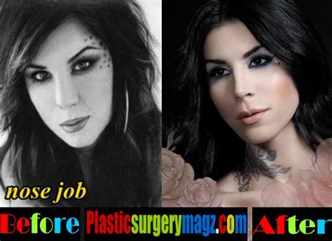Kat Von D Plastic Surgery Gossip Finally Revealed Plastic Surgery