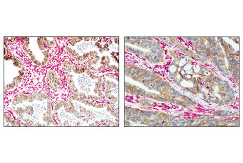 Signalstain® Boost Ihc Detection Reagent Ap Rabbit Cell Signaling