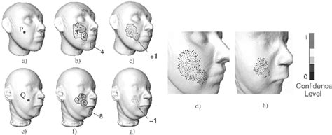 Binary Classification Example A And E Mesh Models Of Normal And Download Scientific Diagram