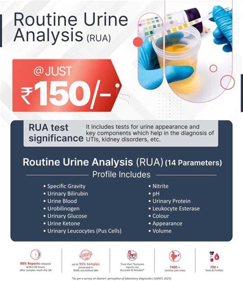 Urine Routine Test 150 Only With Free Home Visit