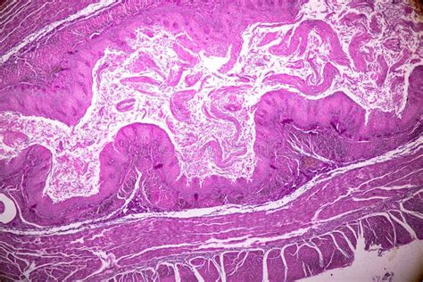 Cerebral Cortex Human Spinal Nerve Motor Neuron Under Microscope Stock