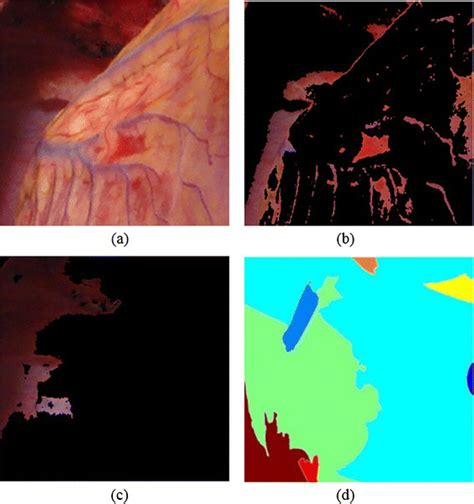 Vessel Segmentation Results From Some General Segmentation Algorithms