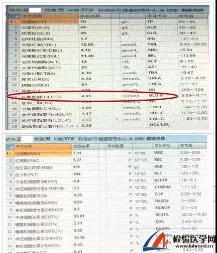 糖化血红蛋白测不出务必要警惕这个原因 MedSci cn