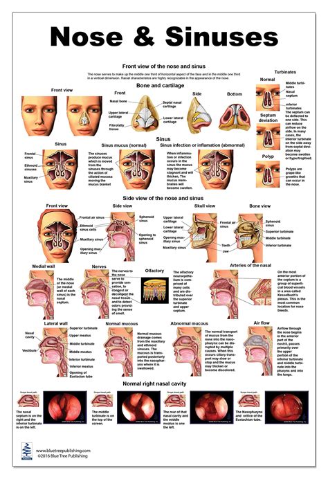 Nose Chart