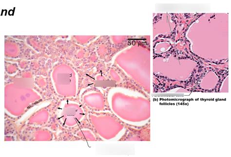 Endocrine Thyroid Gland Cells Slide Diagram Quizlet