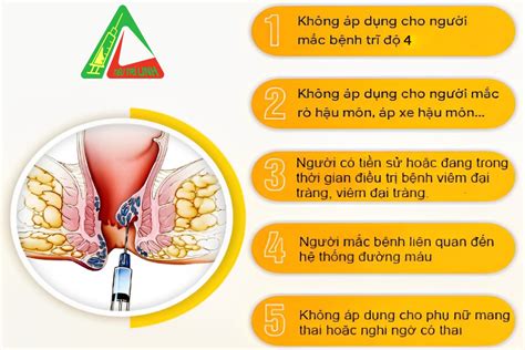 Tiêm Sơ Nội Soi Phương Pháp Mới Chữa Trĩ Không Cần Phẫu Thuật Phòng