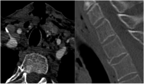 Axial Computed Tomography Soft Tissue Window And Sagittal Bone Window