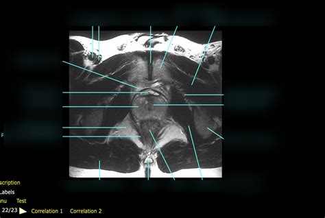 Net Anatomy 22 Diagram Quizlet