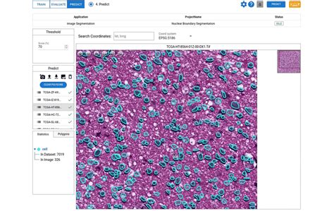 Automated Segmentation Of Mitochondria With Deep Block