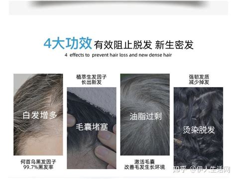 头发稀疏怎么恢复？网红品牌蓝西子洗发水真的能防脱发吗？ 知乎