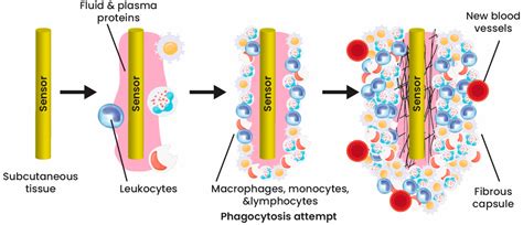 Material Design In Implantable Biosensors Toward Future Personalized Diagnostics And Treatments