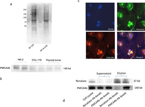 Identification Of Plasma Membrane Calcium ATPase Isoform PMCA4b As A