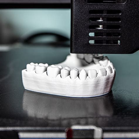 The Rise Of Dental 3d Printers In The Us And Eu Idata Research