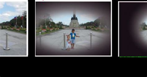 Glaucoma Example Album On Imgur