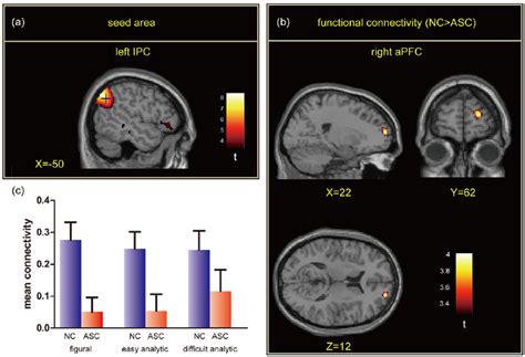 Group Comparison Of Functional Connectivity Throughout All Conditions Download Scientific