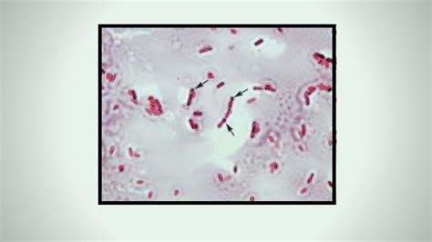 Types Of Stains Used In Microbiology Biology Notes Online