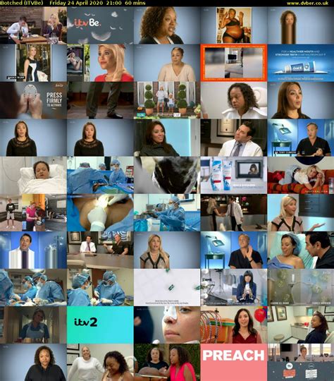 Botched Itvbe 2020 04 24 2100