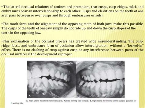 Occlusion