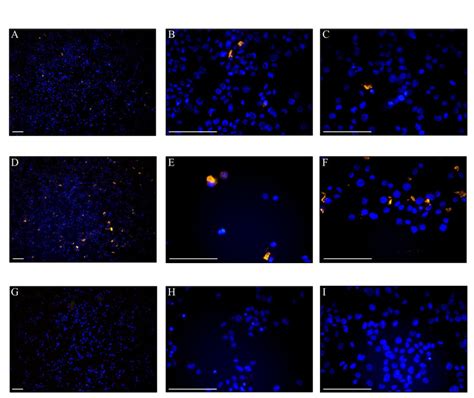Pma Differentiated Thp 1 Cells Incubated Overnight With 2 μg A C Or