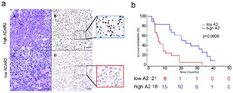 Adar2 Correlates With Patients Overall Survival A Ihc Analysis Hande