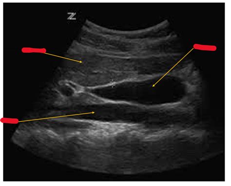 Anatomy Unity 1 Lecture 2 Slide 18 Diagram Quizlet