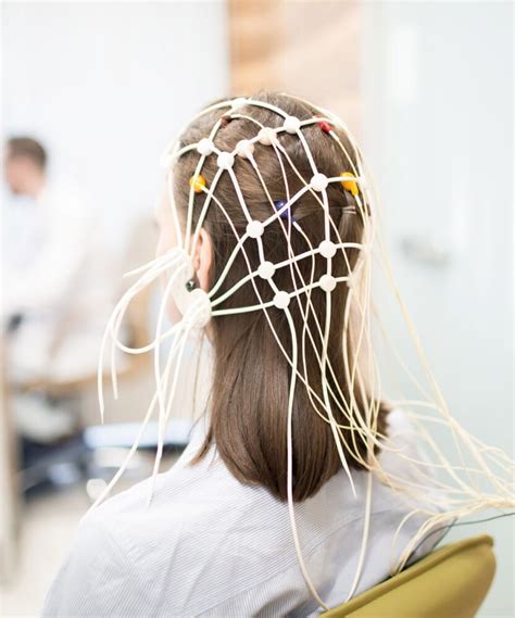 Eletroencefalograma Entenda Como é Feito E A Importância Do Exame Para