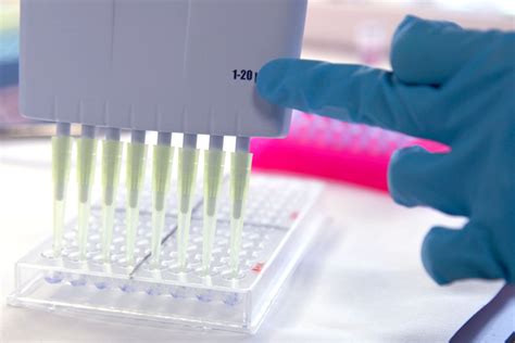 El Blog De Ceess Dos Biomarcadores Mejoran El Diagnóstico Del