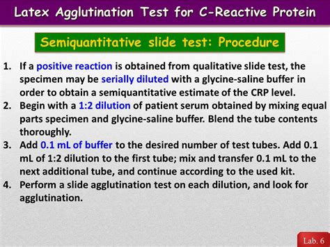 Slide Agglutination Test Procedure