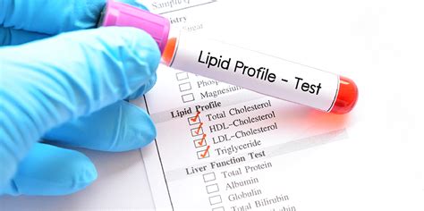 Cardiovascular Disease Prevention Diagnostics Cims India