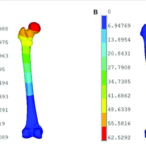Displacement And Stress Distribution Of The Femur Under Physiological Download Scientific