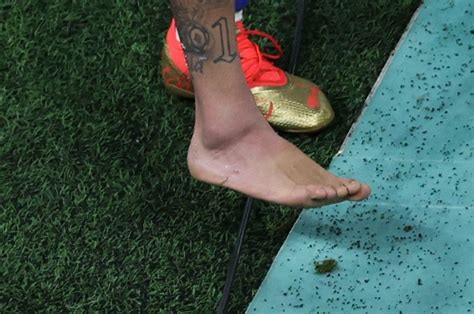 Qatar 2022 ¡alarmas Encendidas Así Quedó El Tobillo De Neymar Tras El