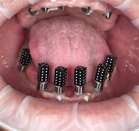 Photogrammetry Records Simplified All Dental Ce