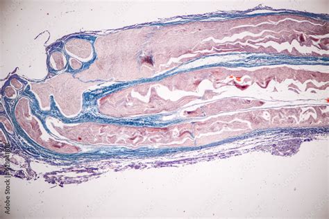 Education Spinal Cord Nerve Cerebellum Cortex And Motor Neuron Human Under The Microscope In