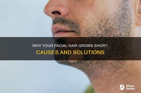 Why Your Facial Hair Grows Short Causes And Solutions Shunsalon
