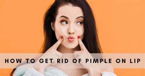 How To Get Rid Of Pimple On Lip In 2024 Total Stable