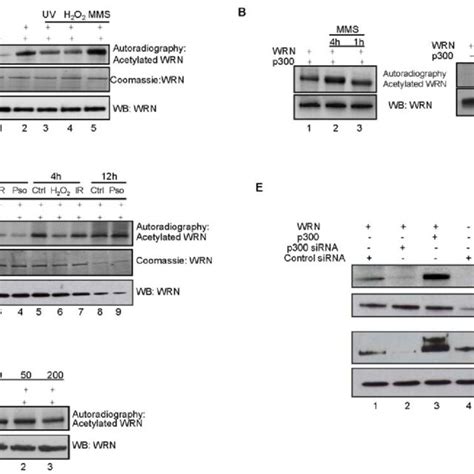 acetylation of wrn stimulates strand displacement dna synthesis by