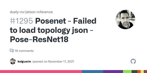 Posenet Failed To Load Topology Json Pose Resnet18 · Issue 1295