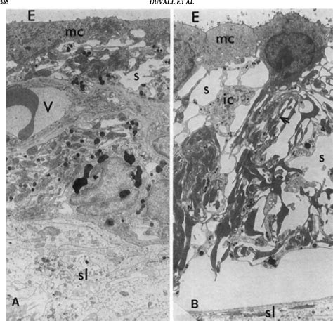 Figure 1 From Cochlear Fluid Balance Semantic Scholar