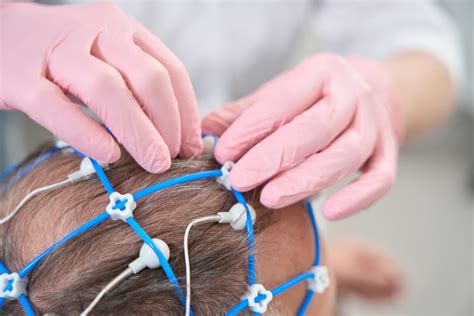 Estimulação Cerebral Não Invasiva Pode Regular Respostas Autonômicas E